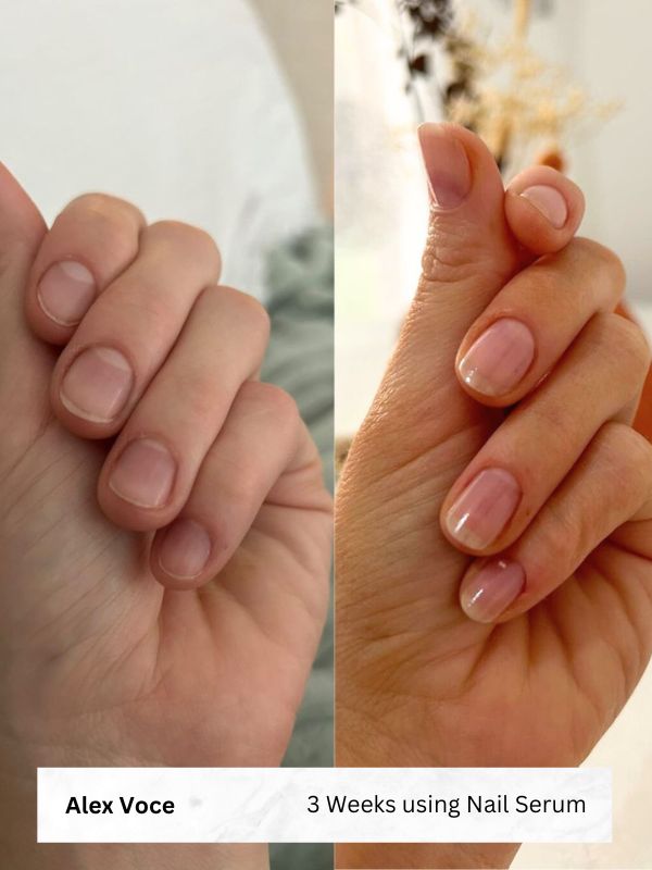 Nail Growth For Women Over 35+ – Body Collective Co